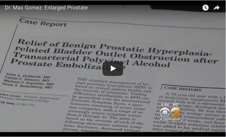 Urolift New Relief From Enlarged Prostate Health News Hub